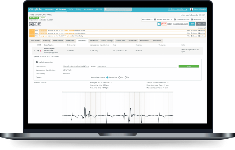 ILR ECG Analyzer - Implicity
